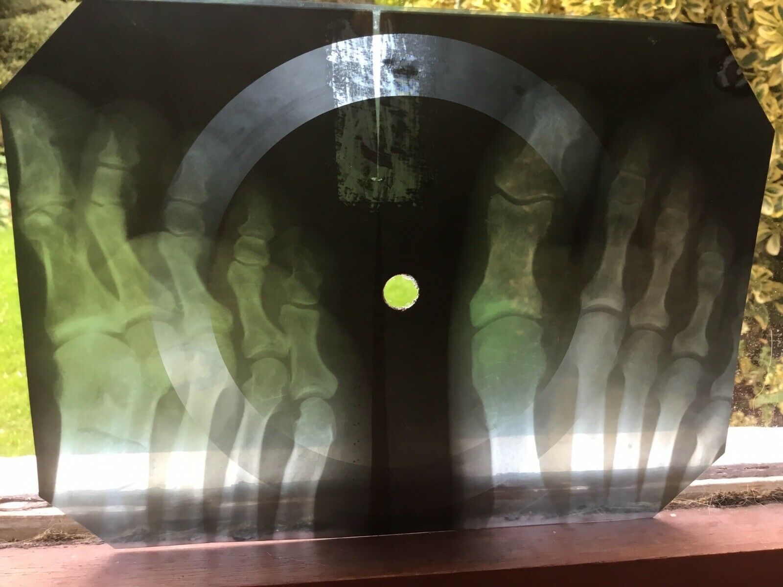 Led Zeppelin - The Immigrant Song - Soviet Bone Music On X - Ray ...