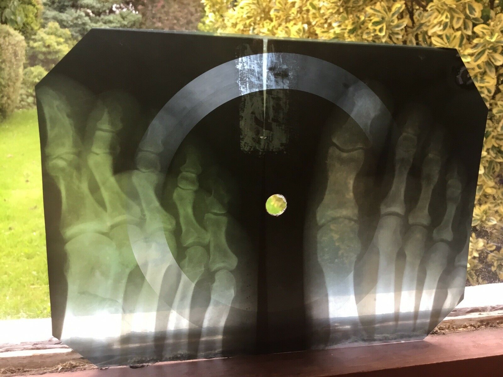 Led Zeppelin - The Immigrant Song - Soviet Bone Music On X - Ray ...